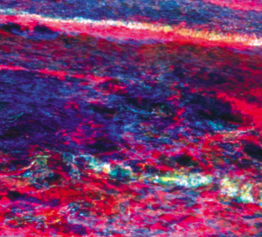 Luke Abbott: A Video Retrospective - Inverted Audio